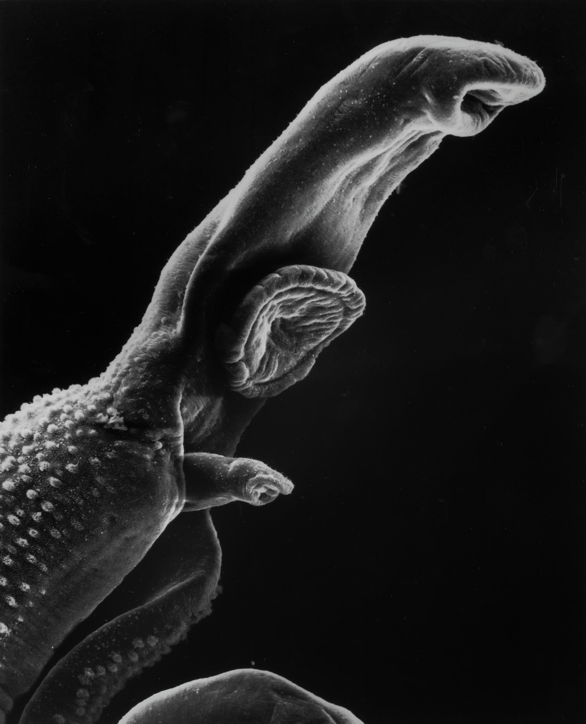 The Ultimate Guide to Parasites – Velle Wellness